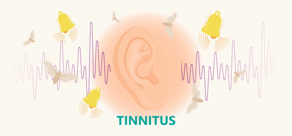 Myth or fact? Test your knowledge about good ear health - UT Health San ...