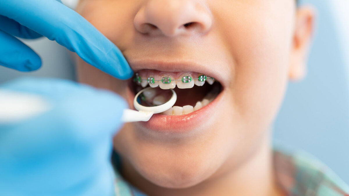 Orthodontics: More than meets the eye - UT Health San Antonio