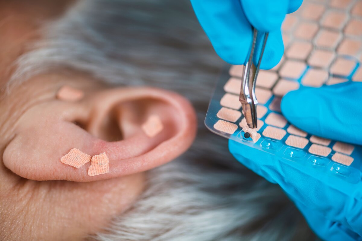 UT Health San Antonio pilot study explores ear acupressure for chronic ...